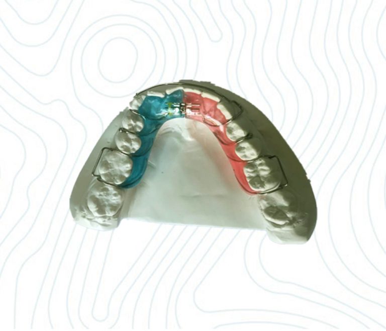 orthodontic-appliance-11 | China Orthodontic