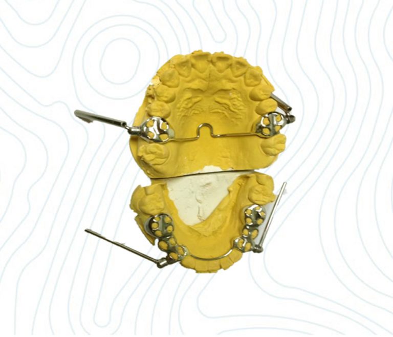 orthodontic-appliance-28 | China Orthodontic